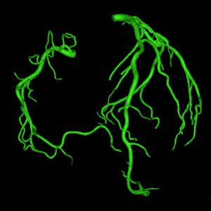 Medical image segmentation - method for learning data preparation