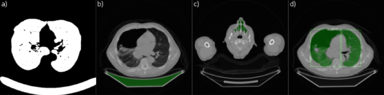 Accurate lung segmentation using conventional image processing