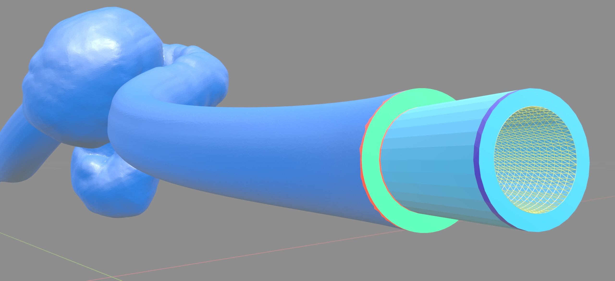 Generating 3D printable mesh models of brain arteries - Graylight Imaging