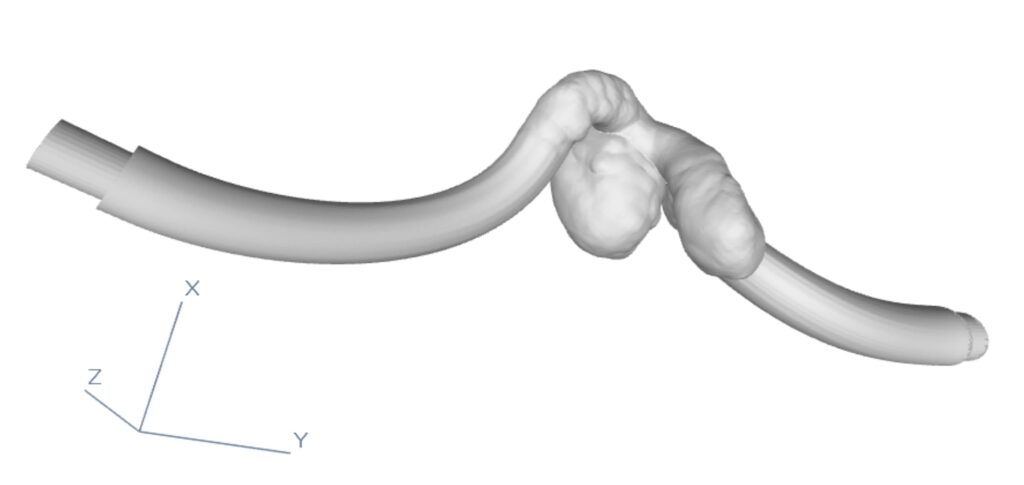 Generating 3D printable mesh models of brain arteries - Graylight Imaging