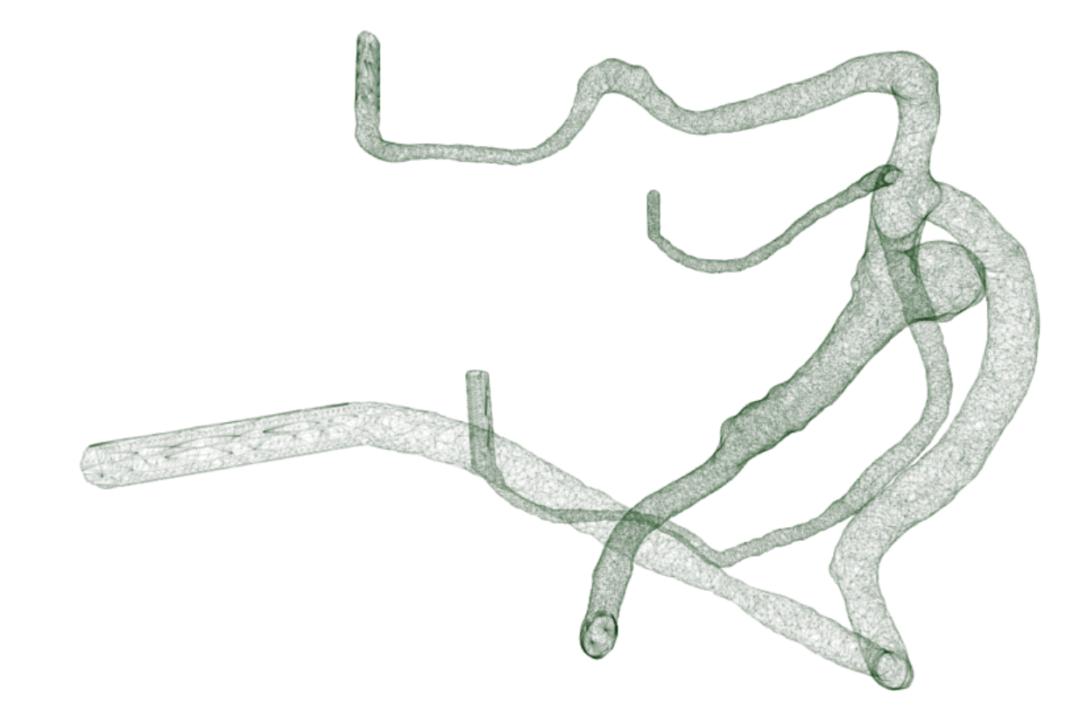DICOM to STL? Patient-specific printable 3D models