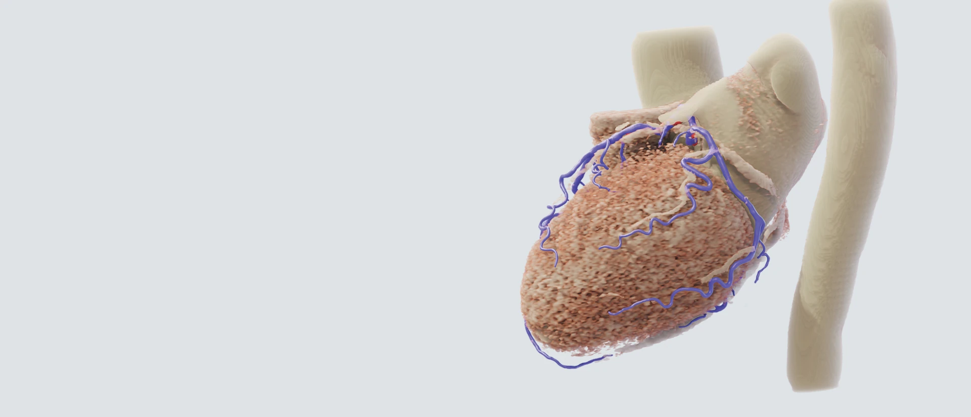 3D medical models: custom software development