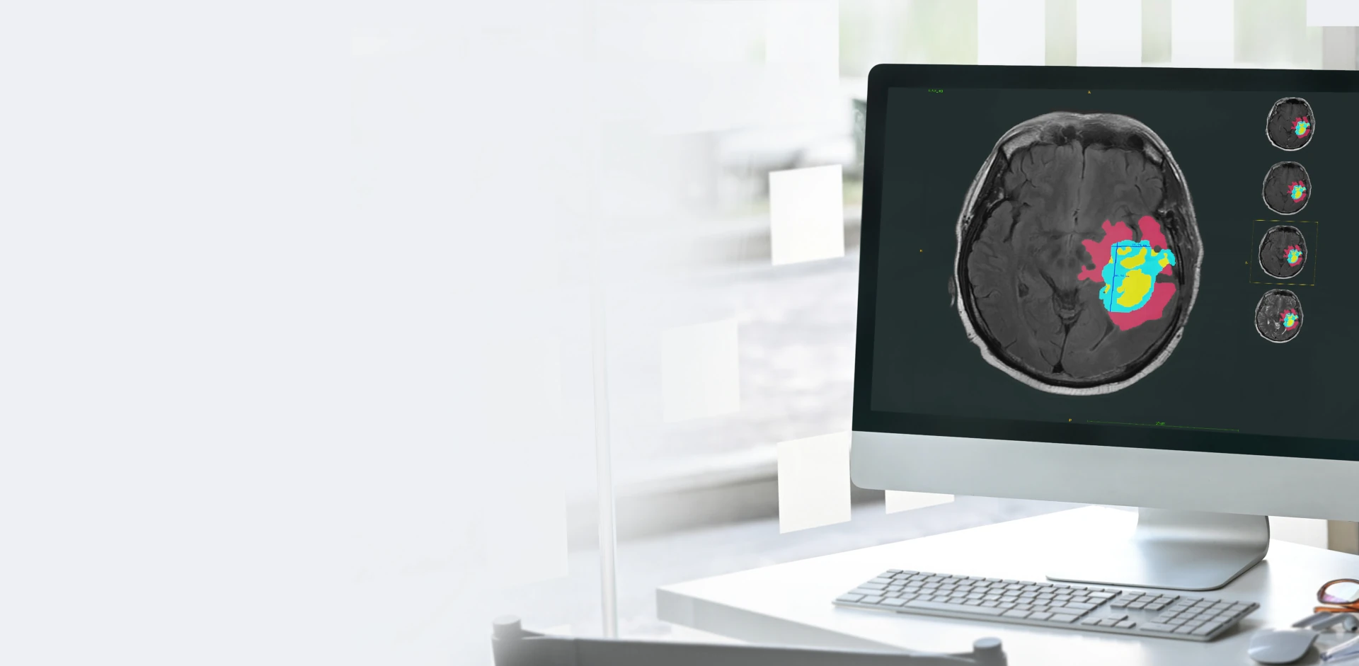 Measurement in medical imaging: AI-based algorithms