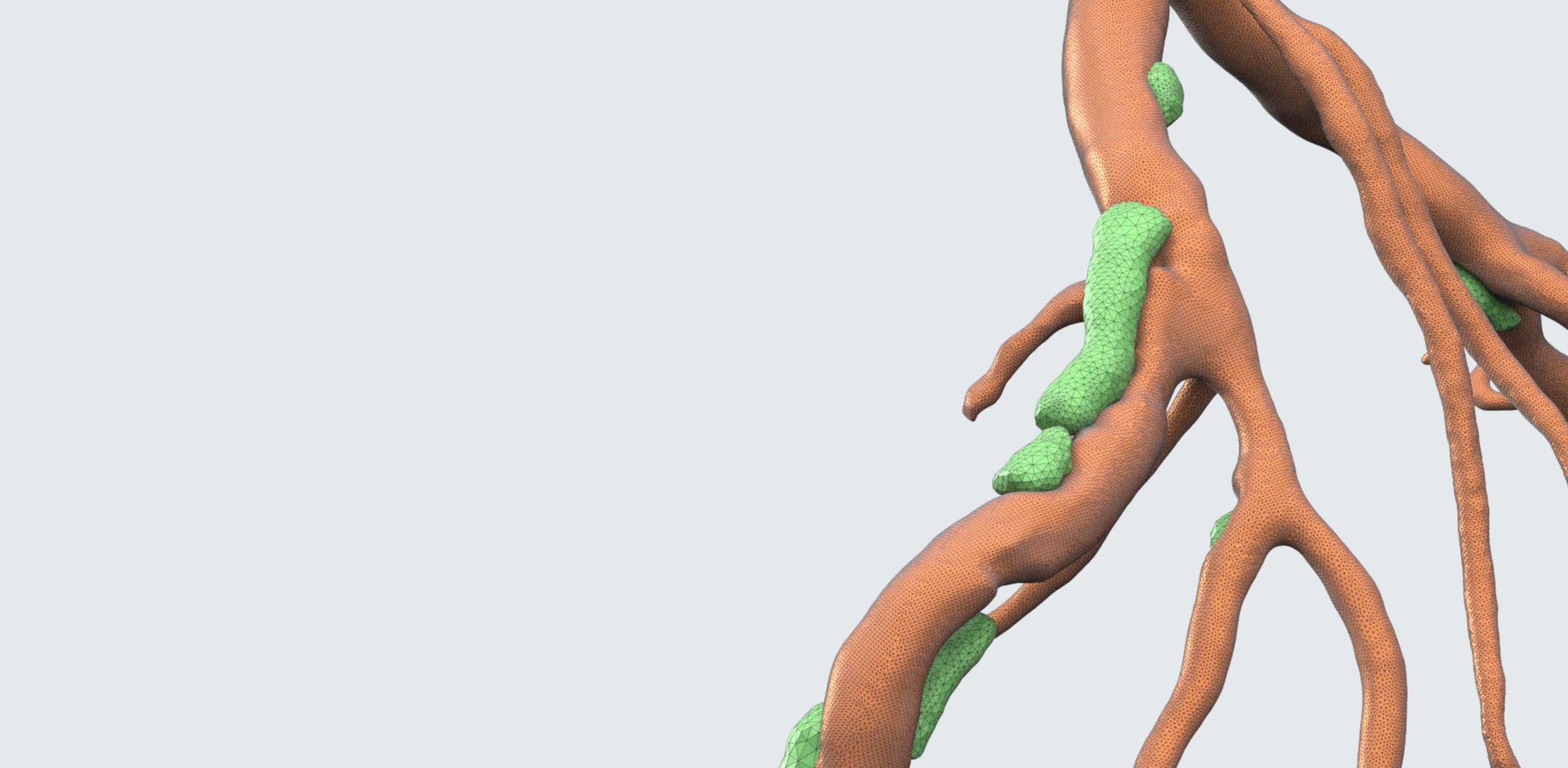 Cardiovascular imaging - Graylight Imaging