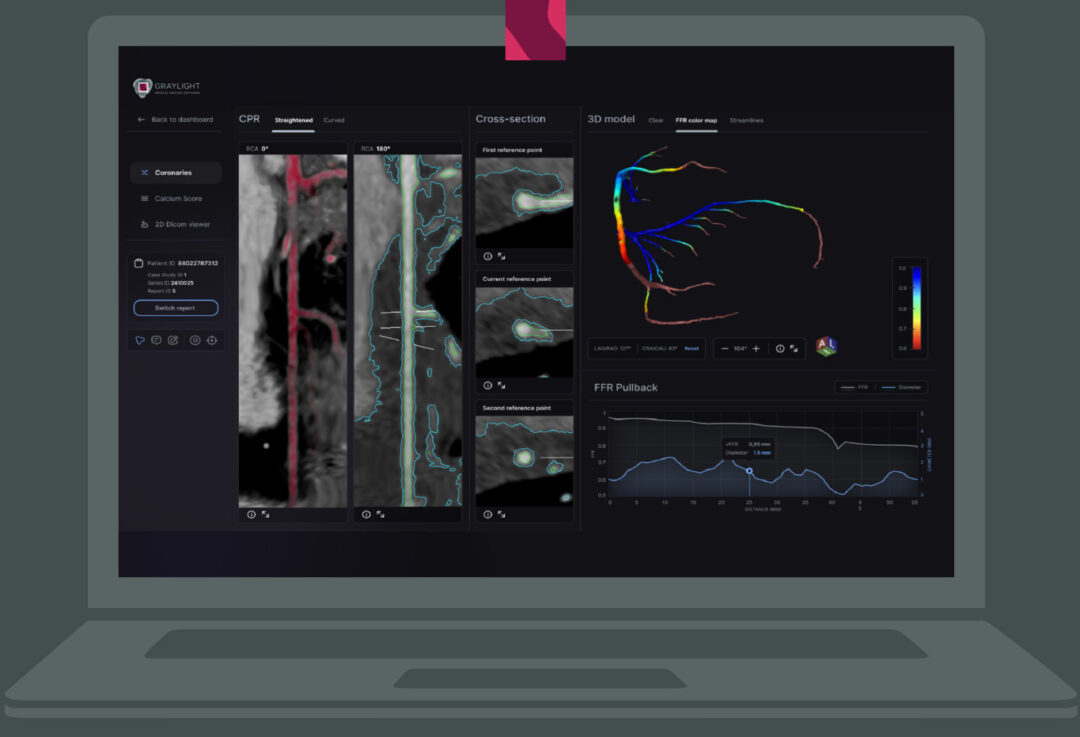 Medical image analysis - Graylight Imaging