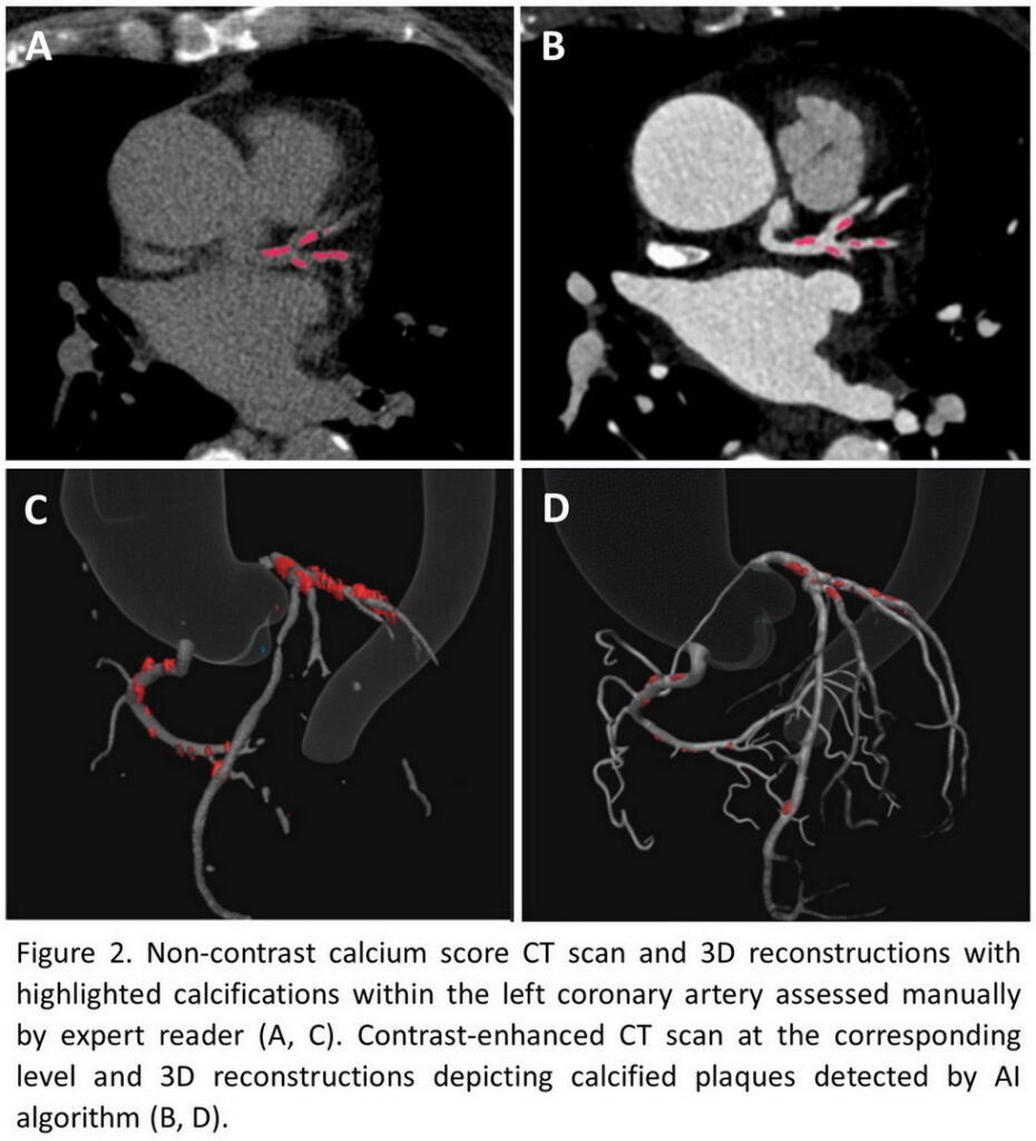 Cardiovascular image analysis: AI and more - Graylight Imaging