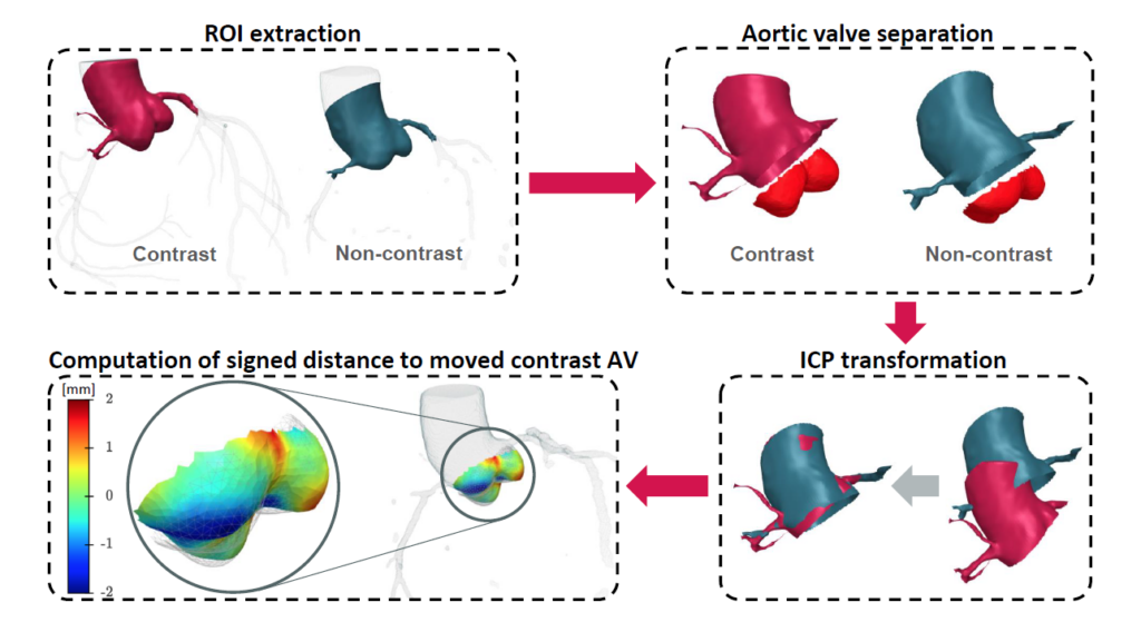 Aortic valve reconstruction in non-contrast CT: a new approach