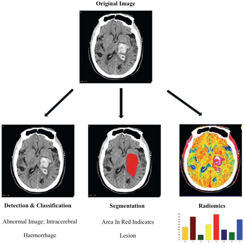 From voxel to diagnosis: AI applications in radiology, part 1 - Graylight Imaging