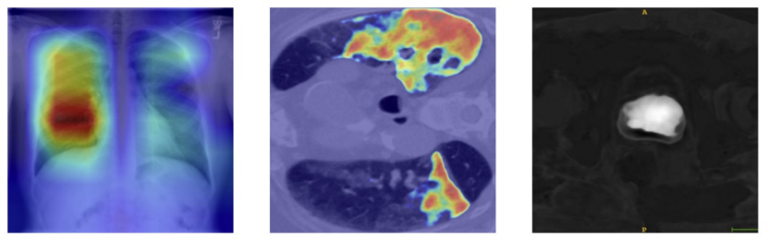 Shedding Light on the Black Box: A Gradient-Based Approach to ...