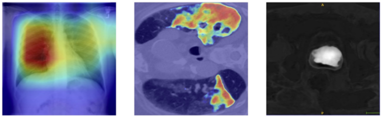 Shedding Light on the Black Box: A Gradient-Based Approach to ...